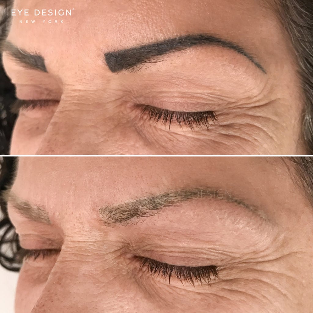 Permanent Makeup Removal - Permanent makeup & Lash Extensions Studio